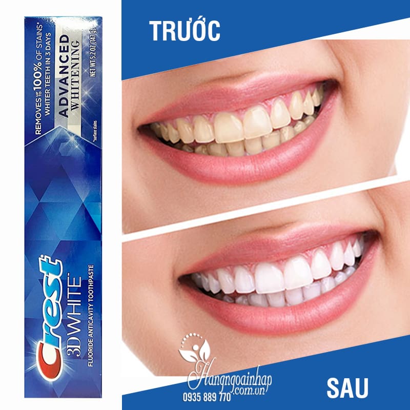 Kem đánh răng Crest 3D White 147g Advanced Whitening của Mỹ