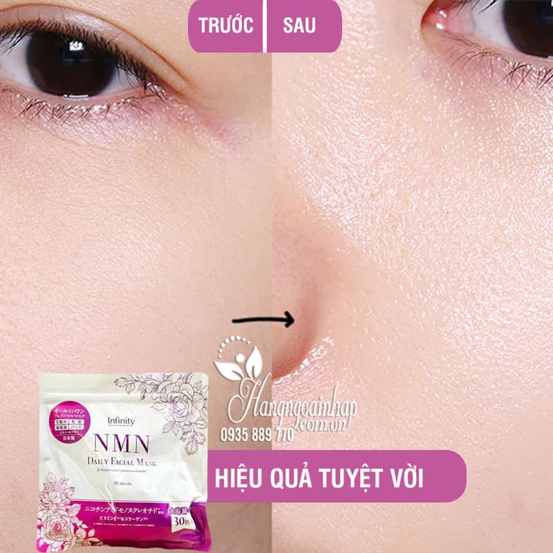 Mặt nạ NMN Infinity Daily Facial Mask cấp ẩm nâng cơ