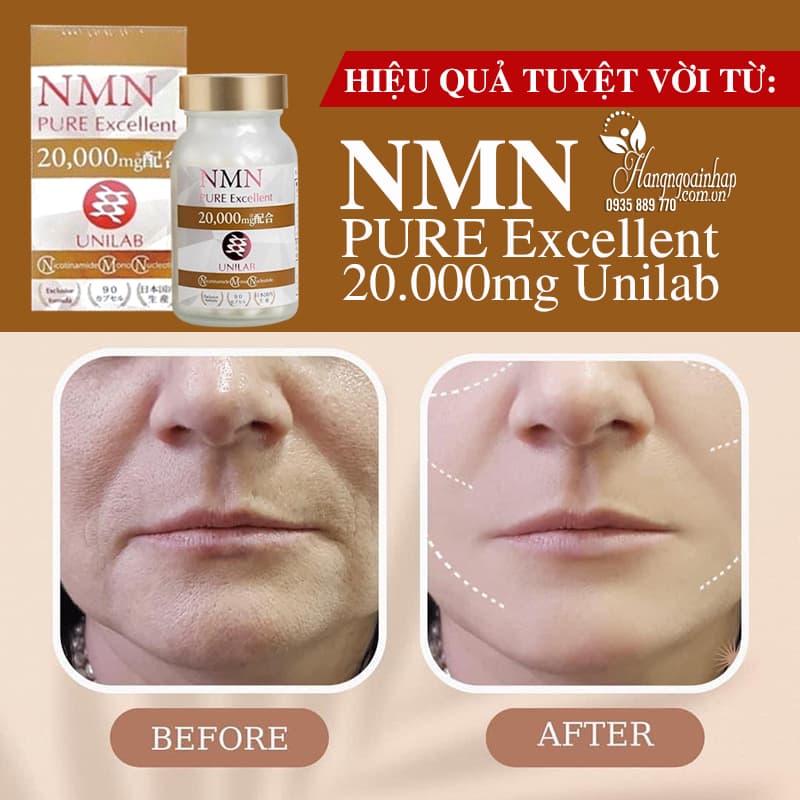 NMN Pure Excellent 20.000mg Unilab Nhật Bản set 2 lọ