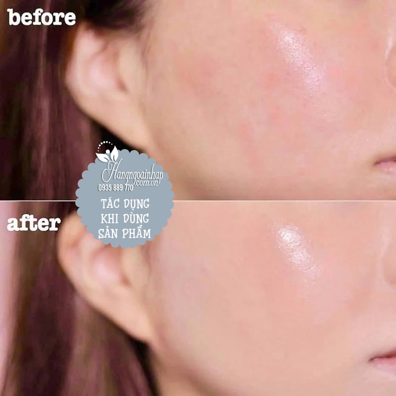 Mặt nạ phục hồi da B5 EGF Complex Mask Kr.Lab Hàn Quốc