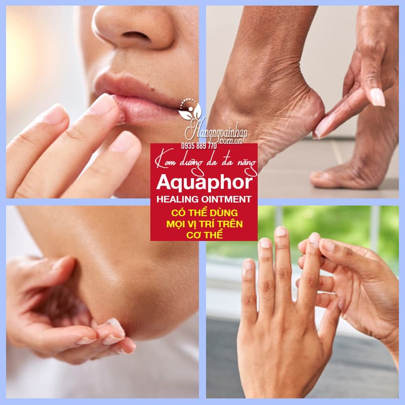 Kem dưỡng da đa năng Aquaphor Healing Ointment 396g của Mỹ